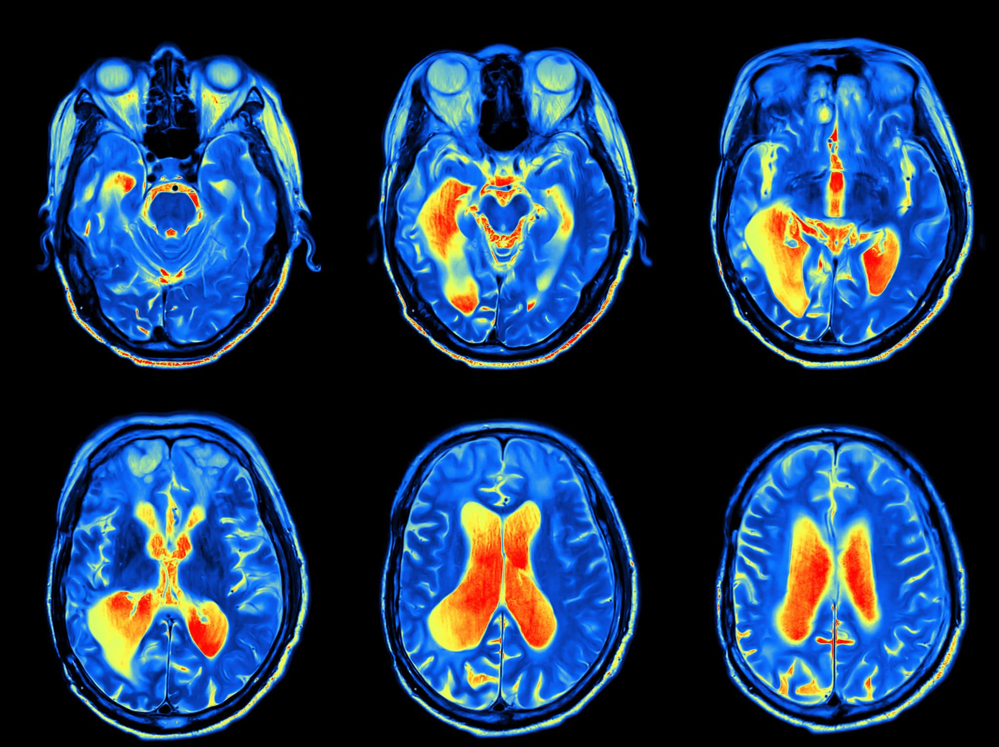 Compassionate Treatment for Skull Base Tumors Starts Here | Spartanburg ...